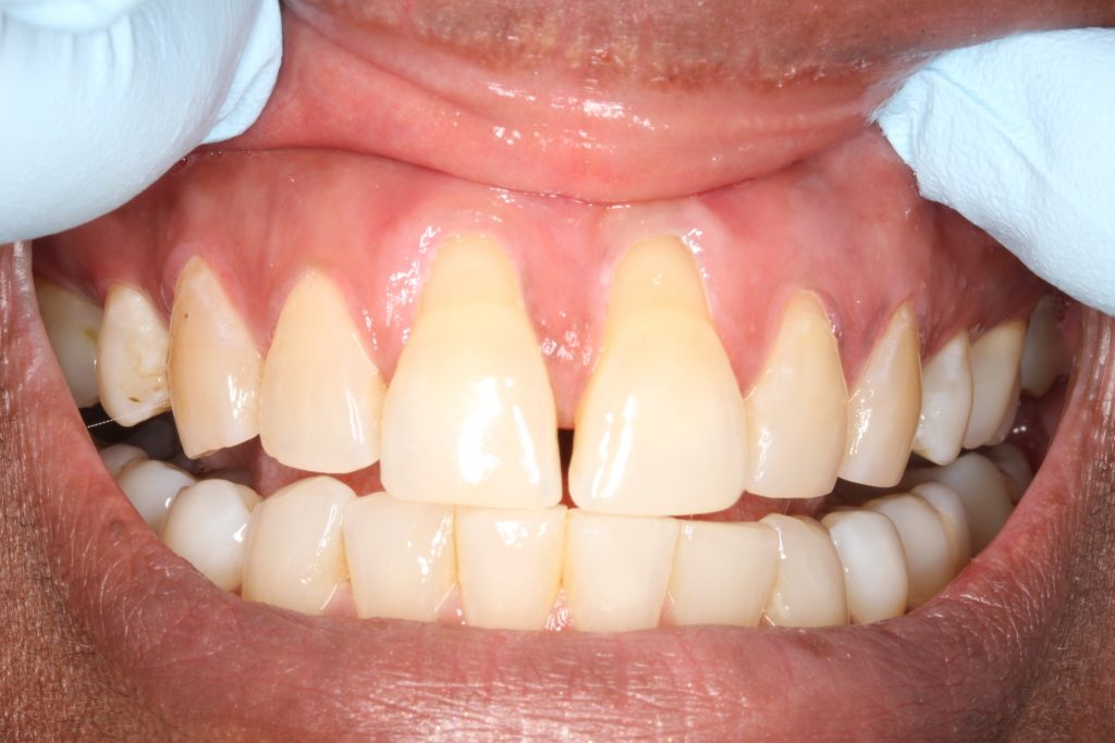 GTA North Periodontics & Endodontics – Periodontist Endodontist ...